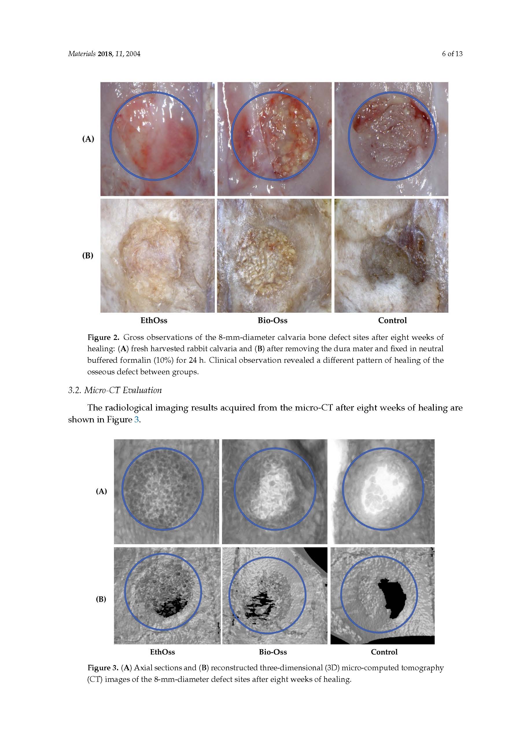 Bone Healing in Rabbit Calvaria Defects Using a Synthetic Bone ...